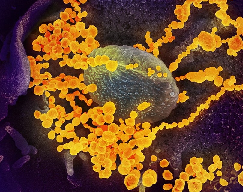 Transmission (TEM) vs Scanning (SEM) Electron Microscopes: What’s the ...