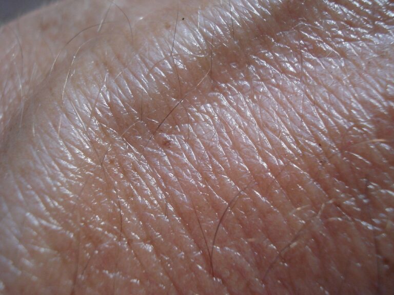 What Is Ultraviolet Light (Ultraviolet Radiation)? Pros, Cons, & FAQ ...