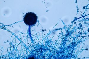 What Does Mold Look Like Under a Microscope? Facts, Types & Tips ...
