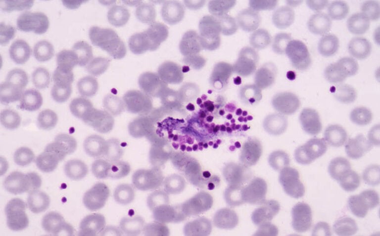 What Does Blood Look Like Under a Microscope? (With Pictures) - Optics Mag