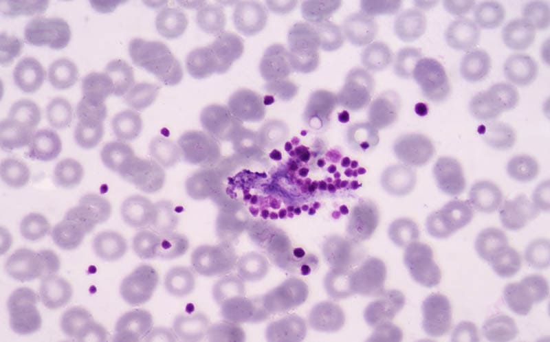 What Does Blood Look Like Under a Microscope? (With Pictures) - Optics Mag