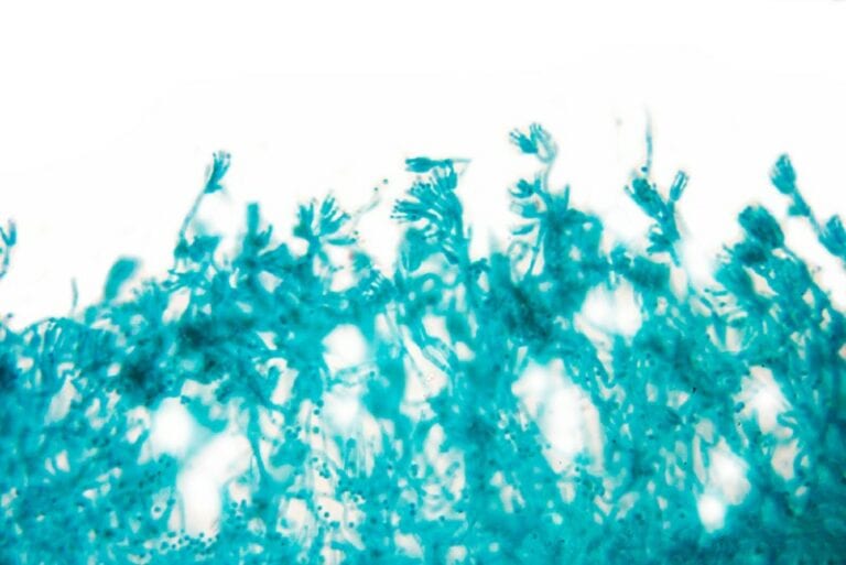 What Does Penicillin Look Like Under a Microscope? (With Pictures ...