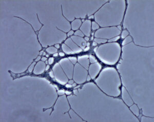Brightfield vs Phase Contrast Microscopy: The Differences Explained ...