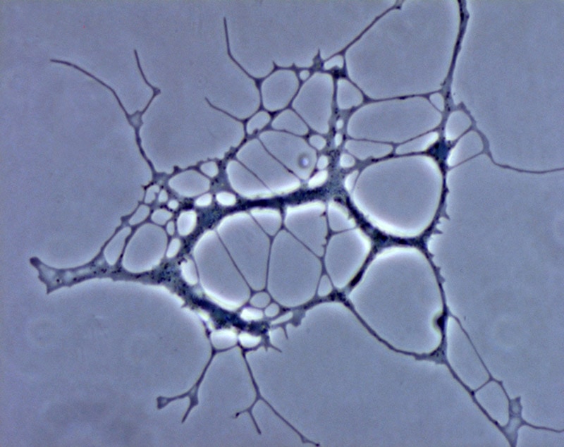 Brightfield vs Phase Contrast Microscopy: The Differences Explained ...