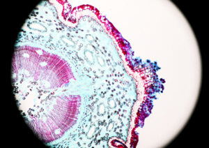 Brightfield vs Phase Contrast Microscopy: The Differences Explained ...