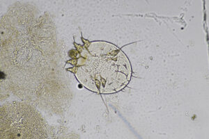 What Do Scabies Look Like Under a Microscope? The Interesting Answer ...