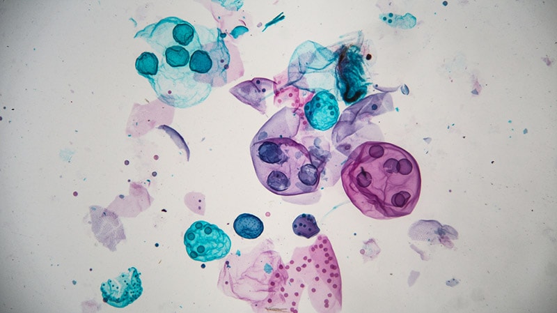 Brightfield vs Phase Contrast Microscopy: The Differences Explained ...